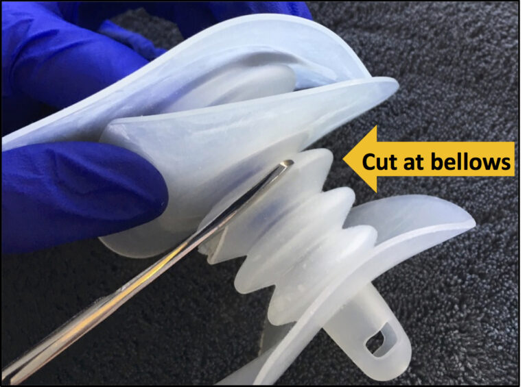 Belted Pouching with Fistula Solution Devices – Fistula Solution