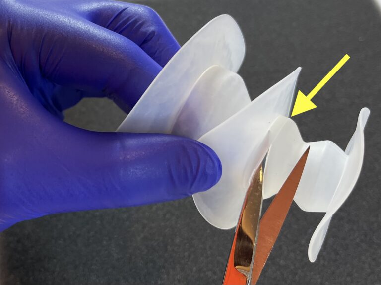 Belted Pouching with Fistula Solution Devices - Fistula Solution