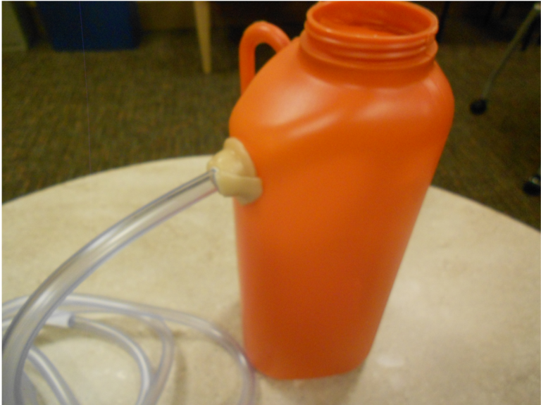 High-output Fistula and Ostomy Effluent Containment - Fistula Solution