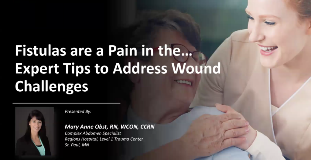 Knowledge Center - Fistula Solution