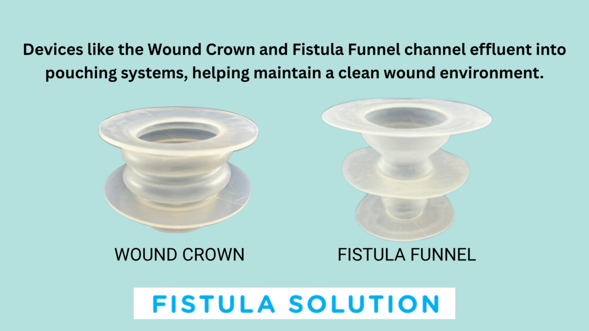 Honoring the Heroes of Fistula Care: 4 Ways to Strengthen Skin & Sepsis ...